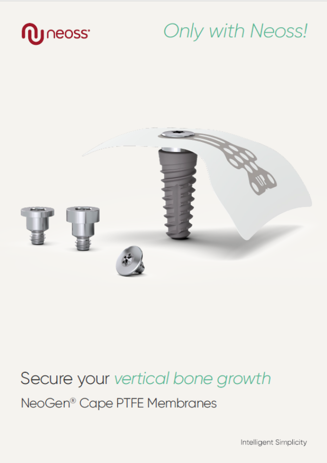 Neoss - Intelligent Simplicity