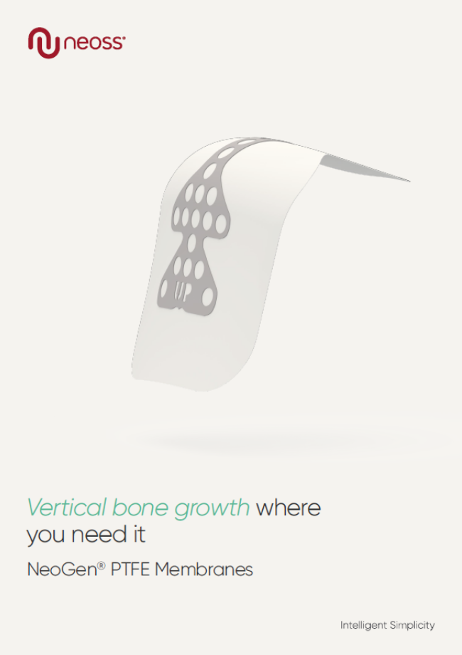Neoss - Intelligent Simplicity